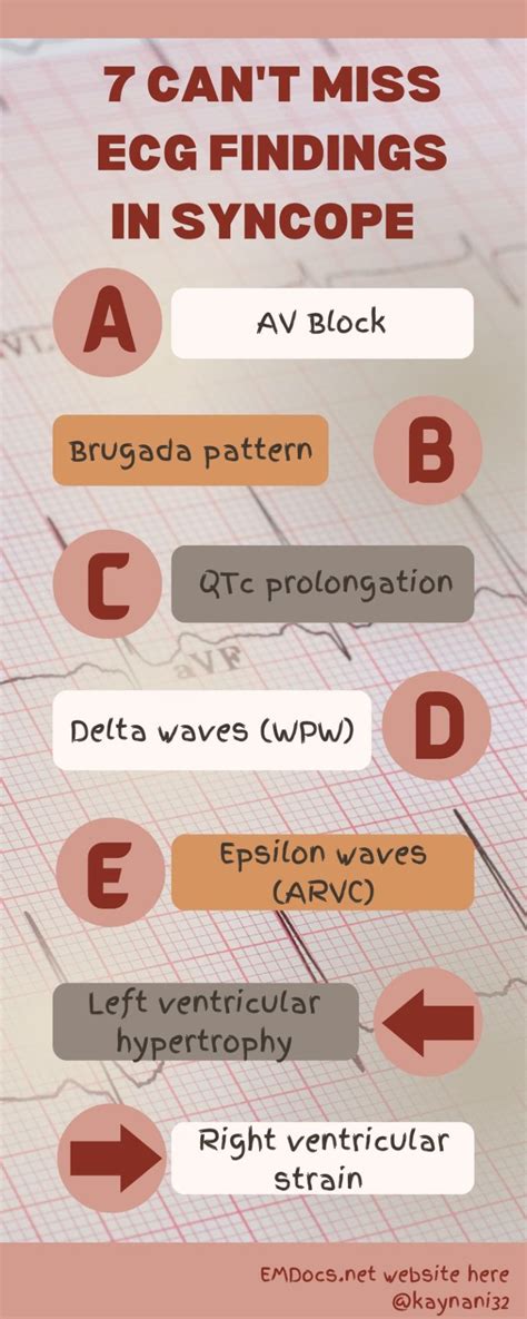 Ecg Pointers 7 Cant Miss Ecg Patterns Of High Risk Syncope The