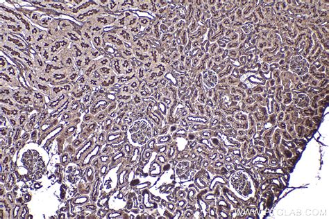 Ihceasy Actb Ready To Use Ihc Kit Khc2345 Proteintech
