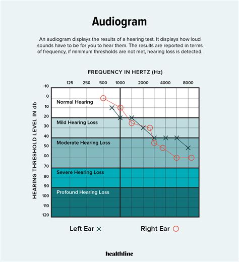 Conductive Hearing Loss Diagram