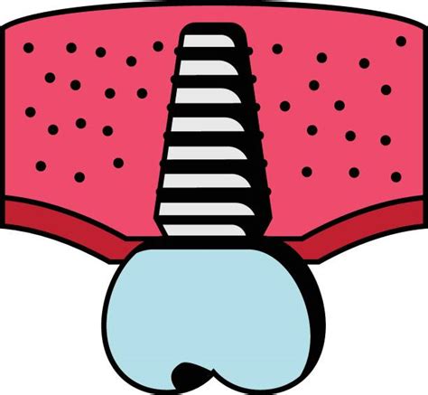 60 Teeth Prothesis Stock Illustrations Royalty Free Vector Graphics And Clip Art Istock