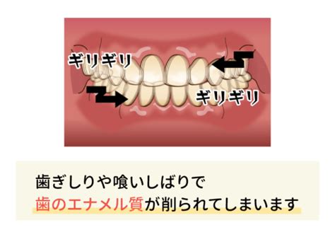 歯がしみる 野田阪神アルプス歯科【公式】野田阪神・海老江・福島区の歯医者さん