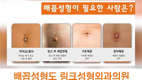 배꼽성형도 링크성형외과 네이버 Tv