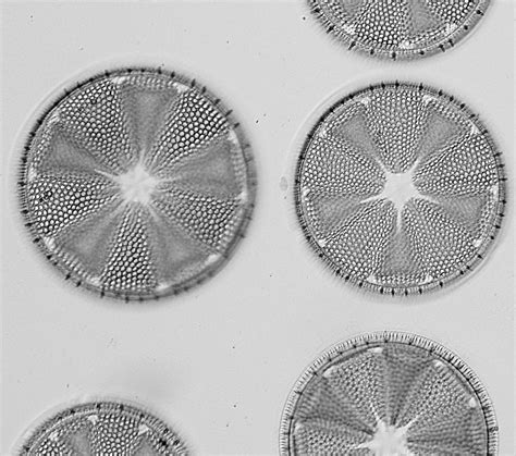 Microscopy Diatom Arrangement And Bacteriastrum Strew Jmc