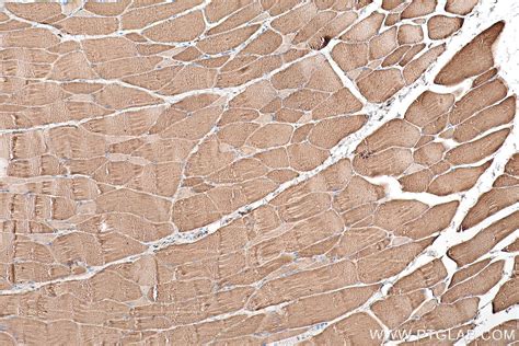 Ihceasy Ndufv1 Ready To Use Ihc Kit Khc0633 Proteintech 武汉三鹰生物技术有限公司