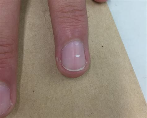 指甲莫名其妙有了白点，根本不需要担心！