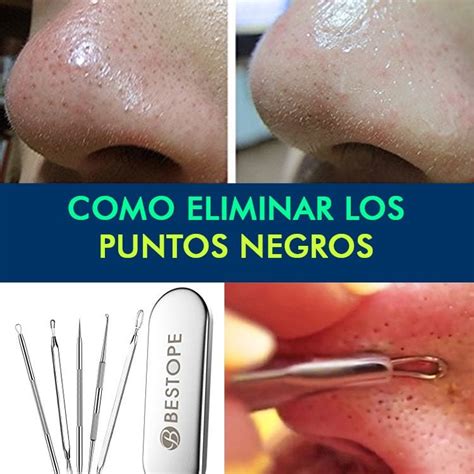 Como Eliminar Los Puntos Negros De La Nariz Rápidamente