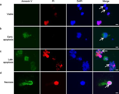 Fluorescence Microscopy Of MCF10A Cells After Treated With 10mM H 2 O 2