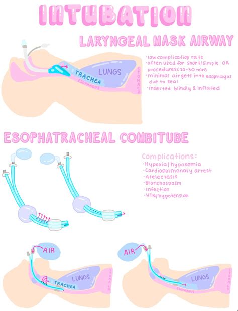 Intubation Notes Artofit