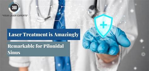 Laser Treatment Is Amazingly Remarkable For Pilonidal Sinus