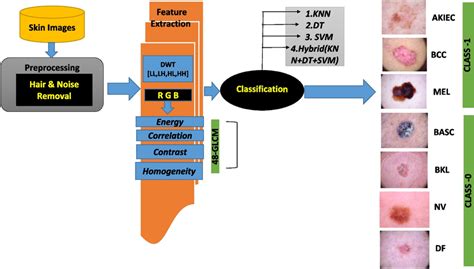A Systematic Proposed Model Diagram For Skin Disease Classification