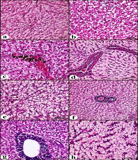 Photomicrographs Of Transverse Sections Of Hepatopancreas Of O