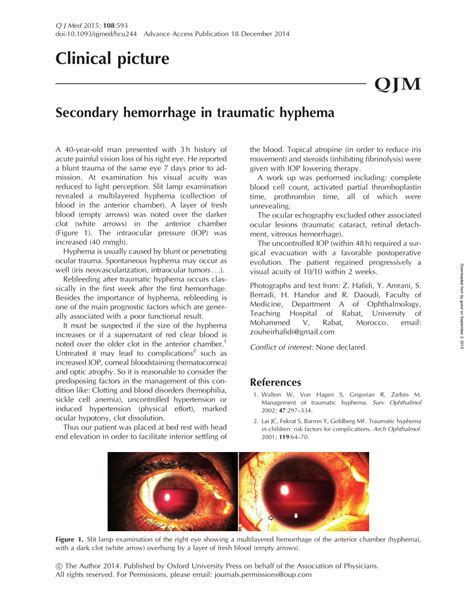 Pdf Secondary Hemorrhage In Traumatic Hyphema