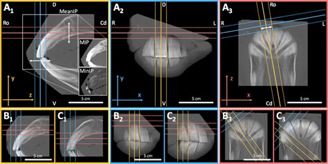 3d Multiplanar Thick Slab Reconstruction Tsr Of Individual Incisors