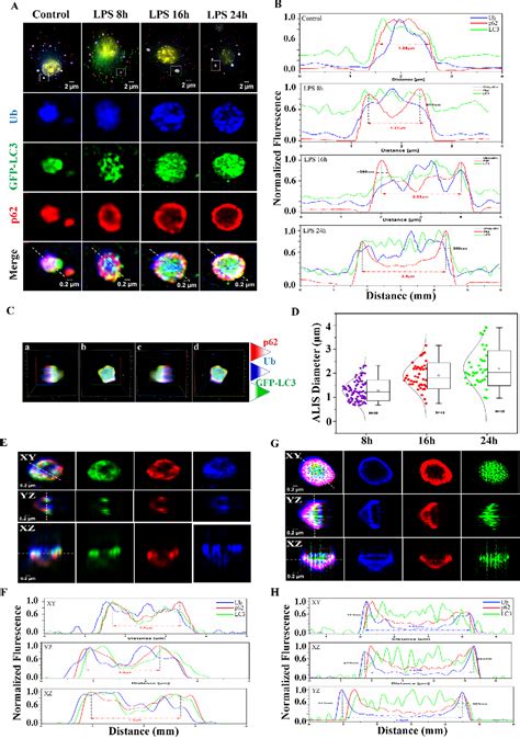 Figure 4 From Tlr Mediated Aggresome Like Induced Structures Comprise