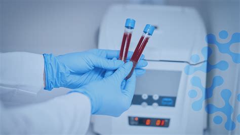 Biyokimya Kan Testi Ena Laboratuvarları