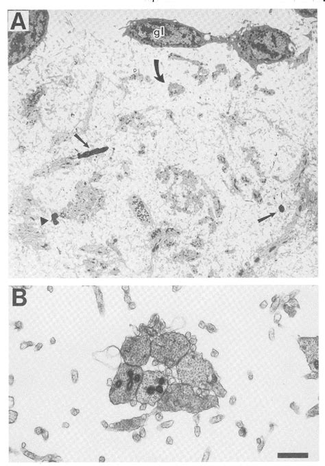 Figure 11 From Pathfinding By Neuronal Growth Cones In Grasshopper