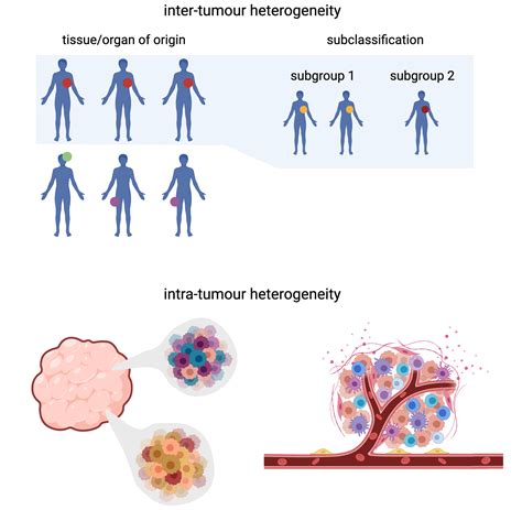 Exploring How Patient Derived Cancer Models Capture Real Tumour