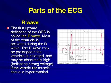 Ppt Ecg Basics Powerpoint Presentation Free Download Id6029627