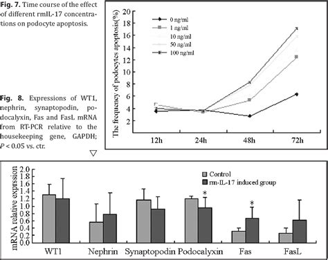 Figure 8 From The Role Of Th17il 17 In The Pathogenesis Of Primary