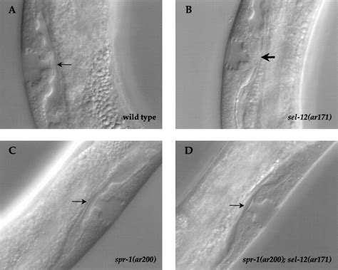 Suppressors Of The Egg Laying Defective Phenotype Of Sel 12 Presenilin Mutants Implicate The