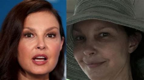 Ashley Judd Rushed To Icu After Shattering Her Leg In Africa