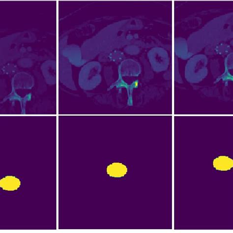 Unet Model Architecture Used For The Training Phase To Generate A Download Scientific Diagram