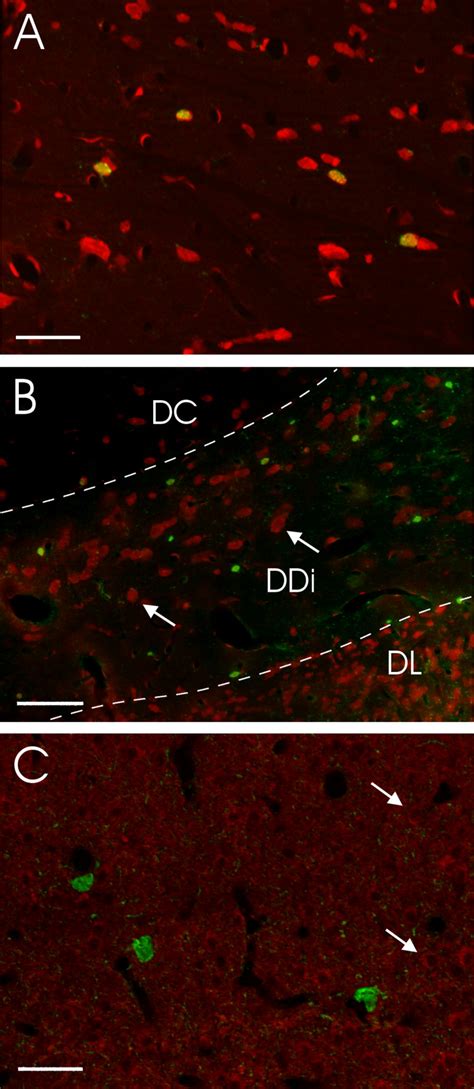 Photomicrographs Of Biotinylated Dextran Amine Filled Neurons In The