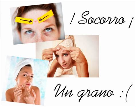 Como Tapar Granitos Con Tu Maquillaje El Tocador De Khimma