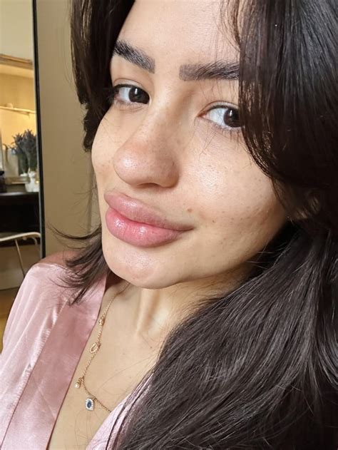 Ive Got The Freckled Nose R Freckledgirls
