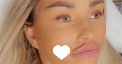 Katie Price Shows Off Her Huge New Pout After Getting Even More Lip