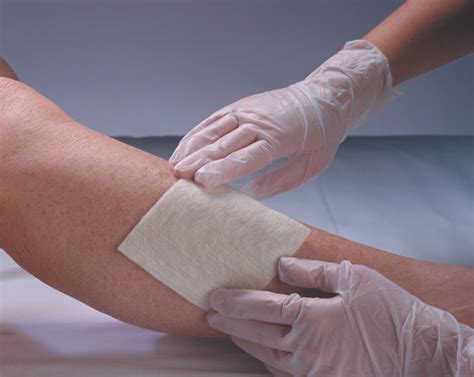 Infomecum Heridas Guía del manejo de heridas y úlceras por presión y