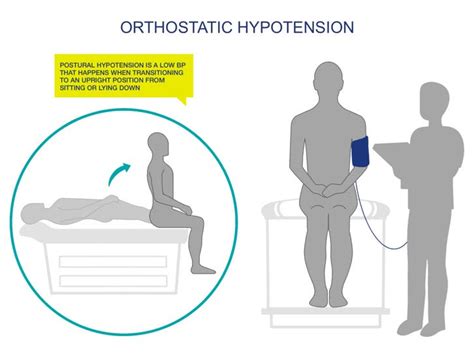 Orthostatic Hypotension Causes Symptoms And Treatment Philadelphia