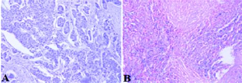Iron Controls At 10x A Iron Negative Tissue B Iron Positive Tissue