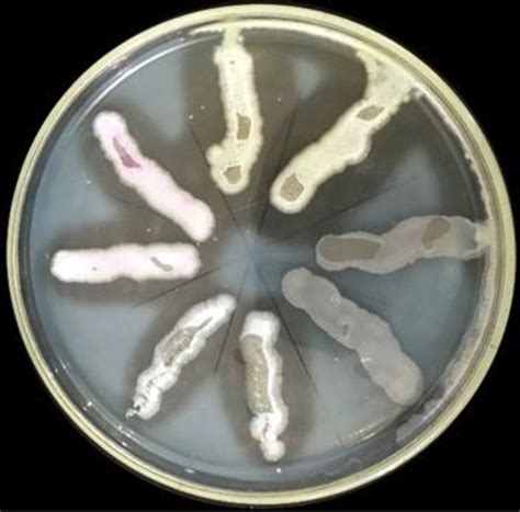 DNAse Test The Clear Zones Around The Bacterial Colonies Indicated