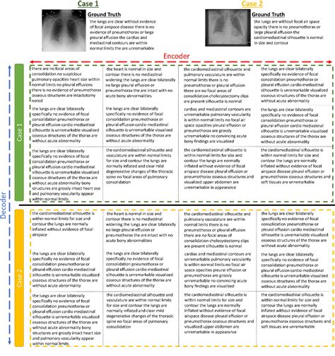 Figure 4 From Vision Transformer And Language Model Based Radiology Report Generation Semantic
