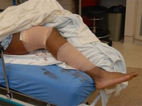 Aqib Talib Gunshot Photos Released After Nfl Player Shot Himself