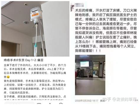 无痛痔疮手术是一种什么样体验 知乎
