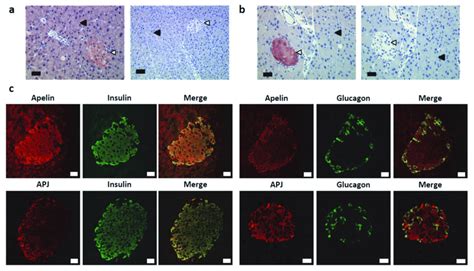 Expression Pattern Of Apelin And Apelin Receptor In Normal Murine