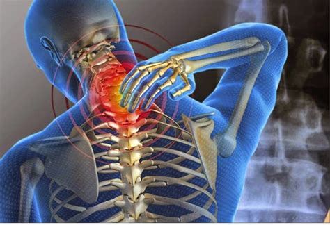 Contractura Muscular Qué Es Cómo Te Afecta Y Tipos Vvsrpo