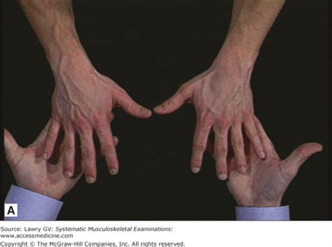The General Musculoskeletal Examination Musculoskeletal Key
