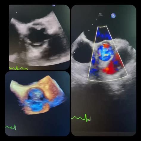 Magnificent Cardiac Case Very Beautiful Very Interesting Superb