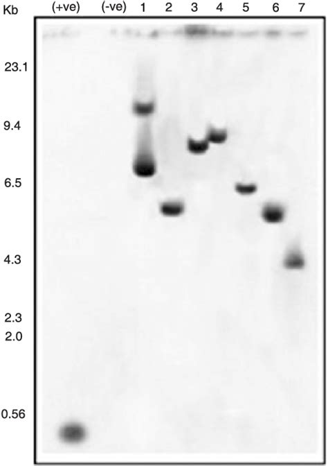 Southern Blot Analyses Of Seven Independent Transgenic Rice Plants