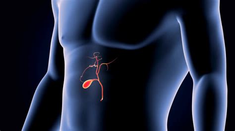 What Is Calculus Of Gallbladder With Acute Cholecystitis Exploring The Link