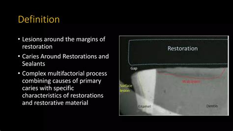 Secondary Caries Overview And Management Pdf
