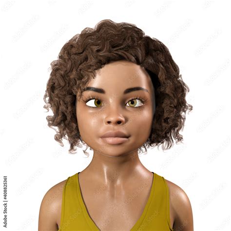 Strabismus Eyes Deviation Illustration Stock Illustration Adobe Stock