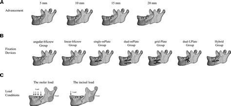 Mandibular Sagittal Split Ramus Osteotomy Was Performed On The Intact Download Scientific