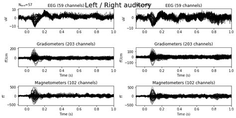 Python Eeg工具库mne中文教程3 Mne中数据结构epoch及其用法简介51cto博客python的mne库