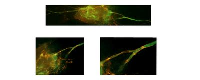Lab Generated Lymph Nodes Connect To Lymphatic System In Mice The Scientist Magazine
