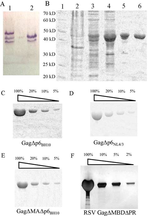 Sds Polyacrylamide Gel Images From Purification Of Recombinant