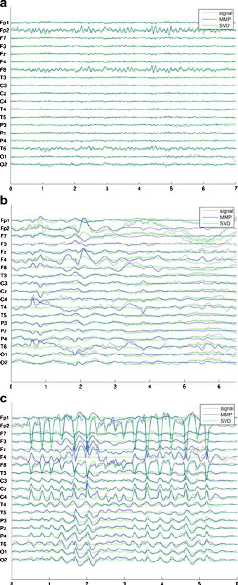 Example Projections Of Features Extracted In The First Svd Component Download Scientific